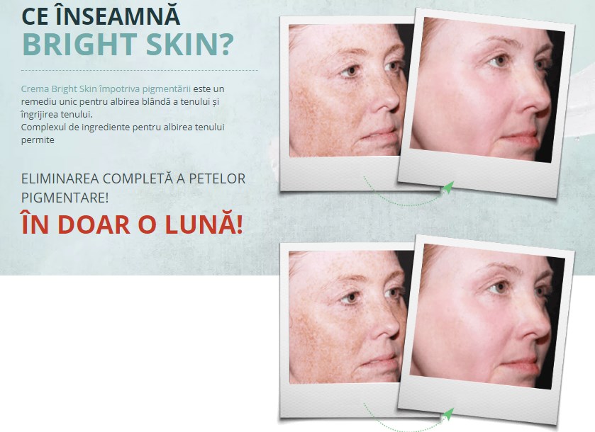 Bright Skin ᐉ pret [50% reducere] - pareri, prospect, forum ...